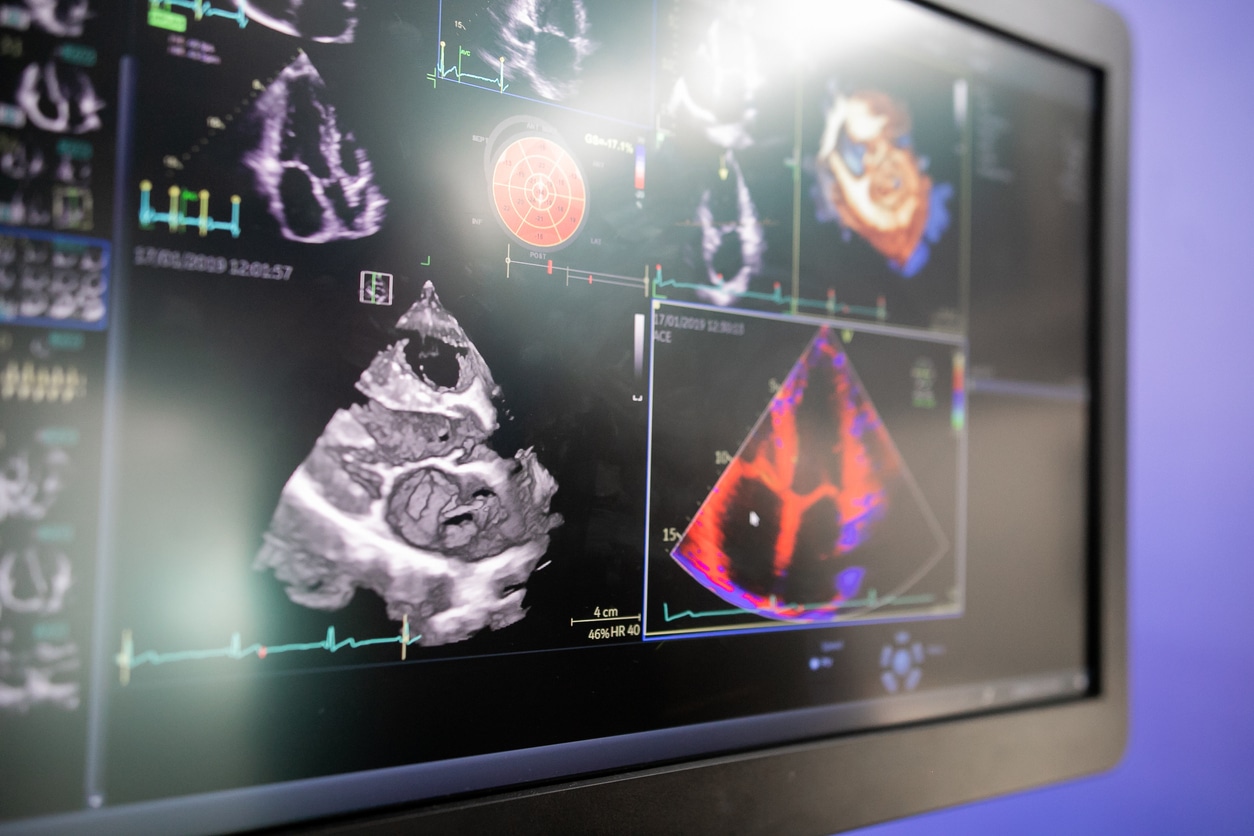 Cardio-oncology Clinic at South Denver Cardiology